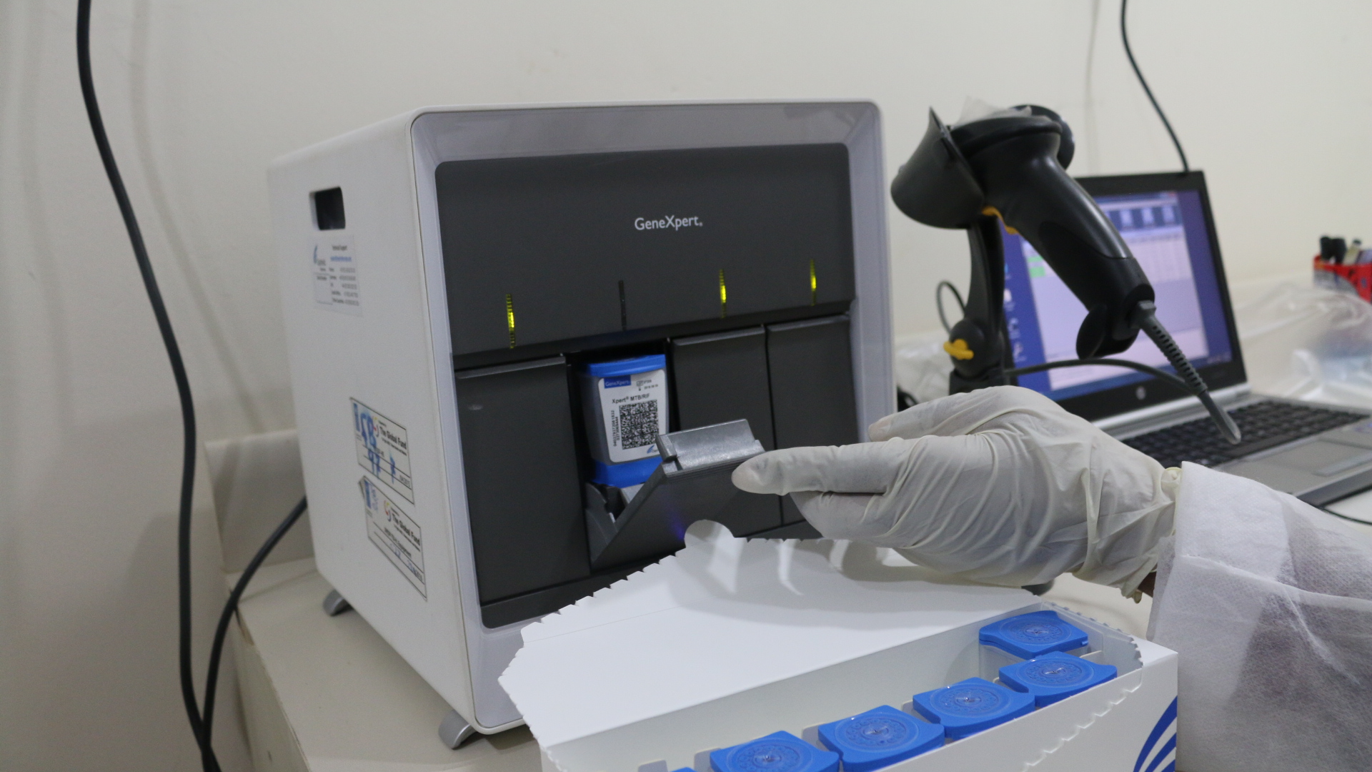 A t on Besoin De Poste De S curit Microbiologique Pour Manipuler Le GeneXpert a-t-on-besoin-de-poste-de-s-curit-microbiologique-pour-manipuler-le-genexpert
